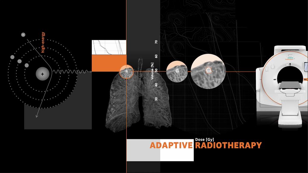 Imaging for Radiation Therapy - Siemens Healthineers