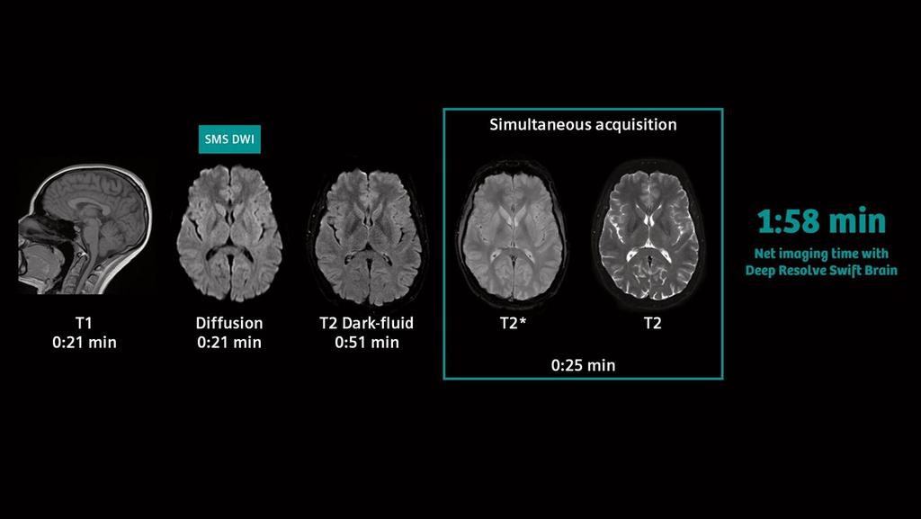 Deep Resolve - Siemens Healthineers USA