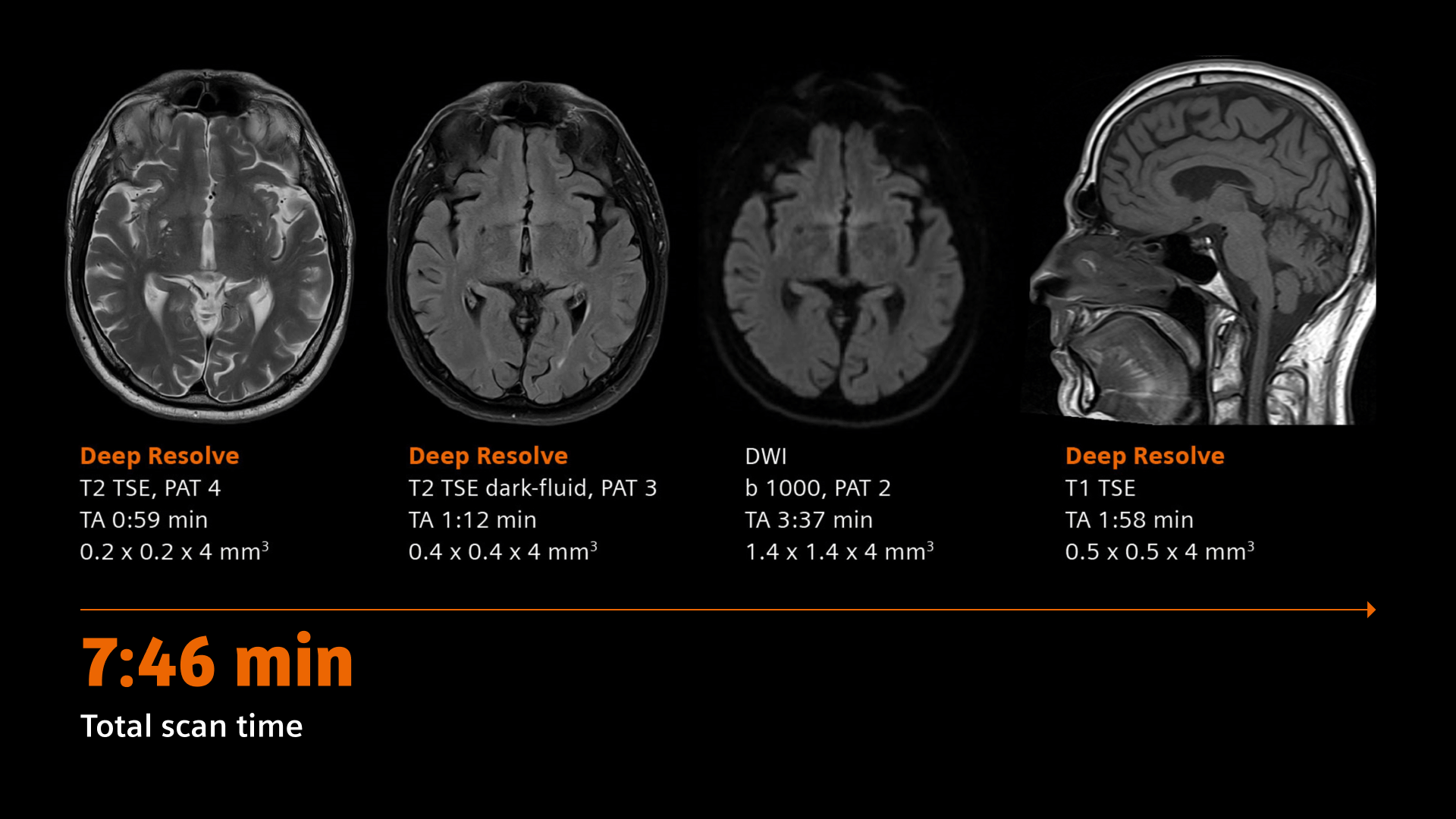 MAGNETOM Flow.Ace - Siemens Healthineers USA