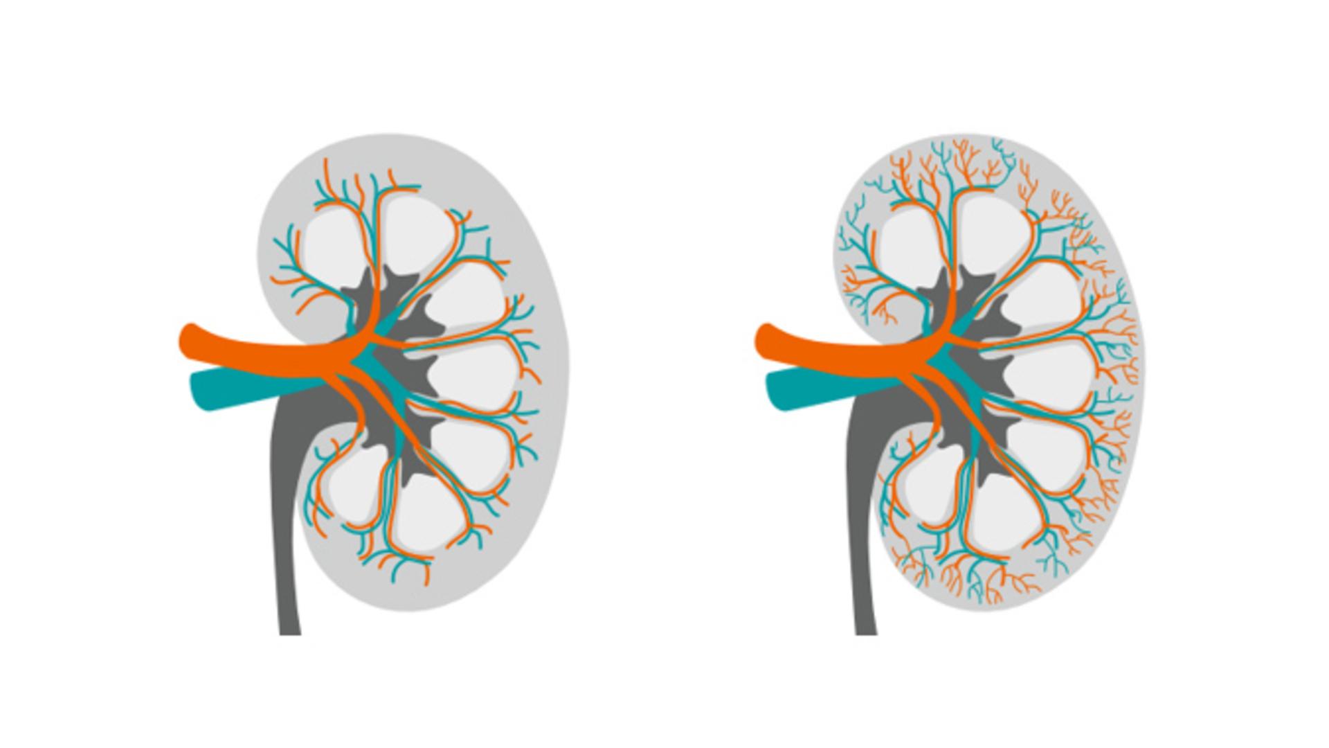 Slow Flow State whitepaper - Siemens Healthineers USA