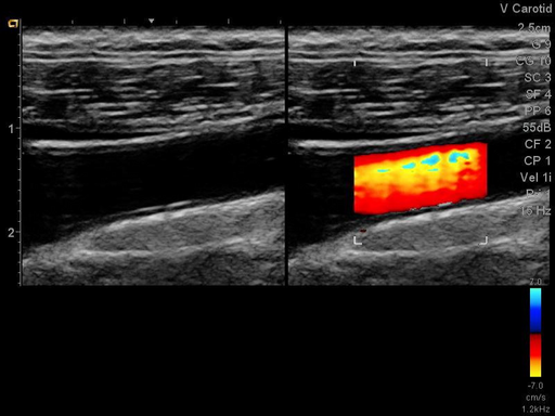 ACUSON Freestyle Wireless Ultrasound System - Siemens Healthineers