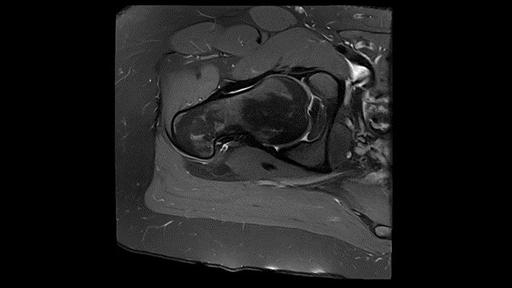 Explore clinical images from the MAGNETOM portfolio with Deep Resolve ...