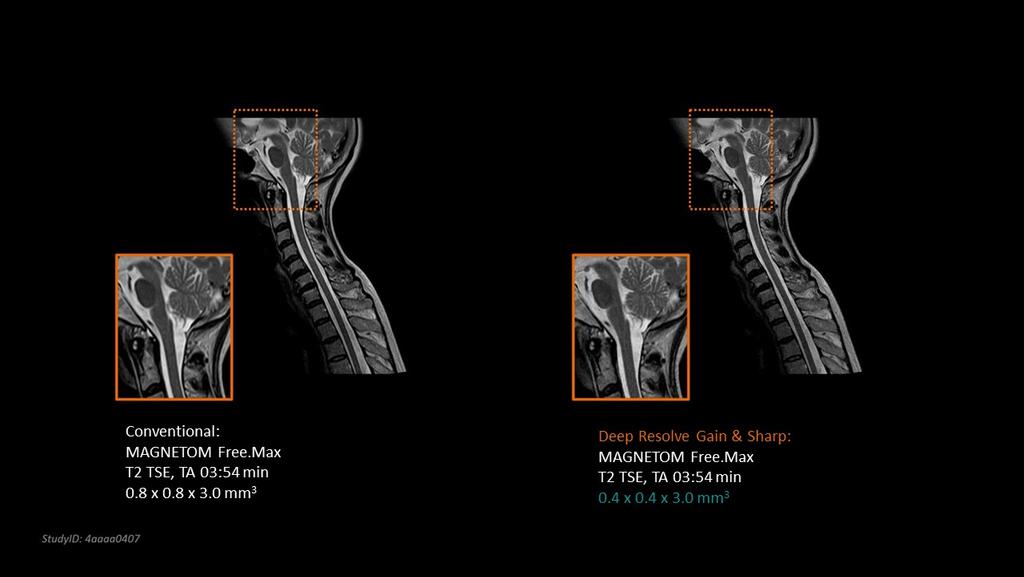 Deep Resolve - Siemens Healthineers USA
