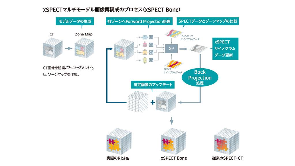 xSPECT Bone - Siemens Healthineers Japan