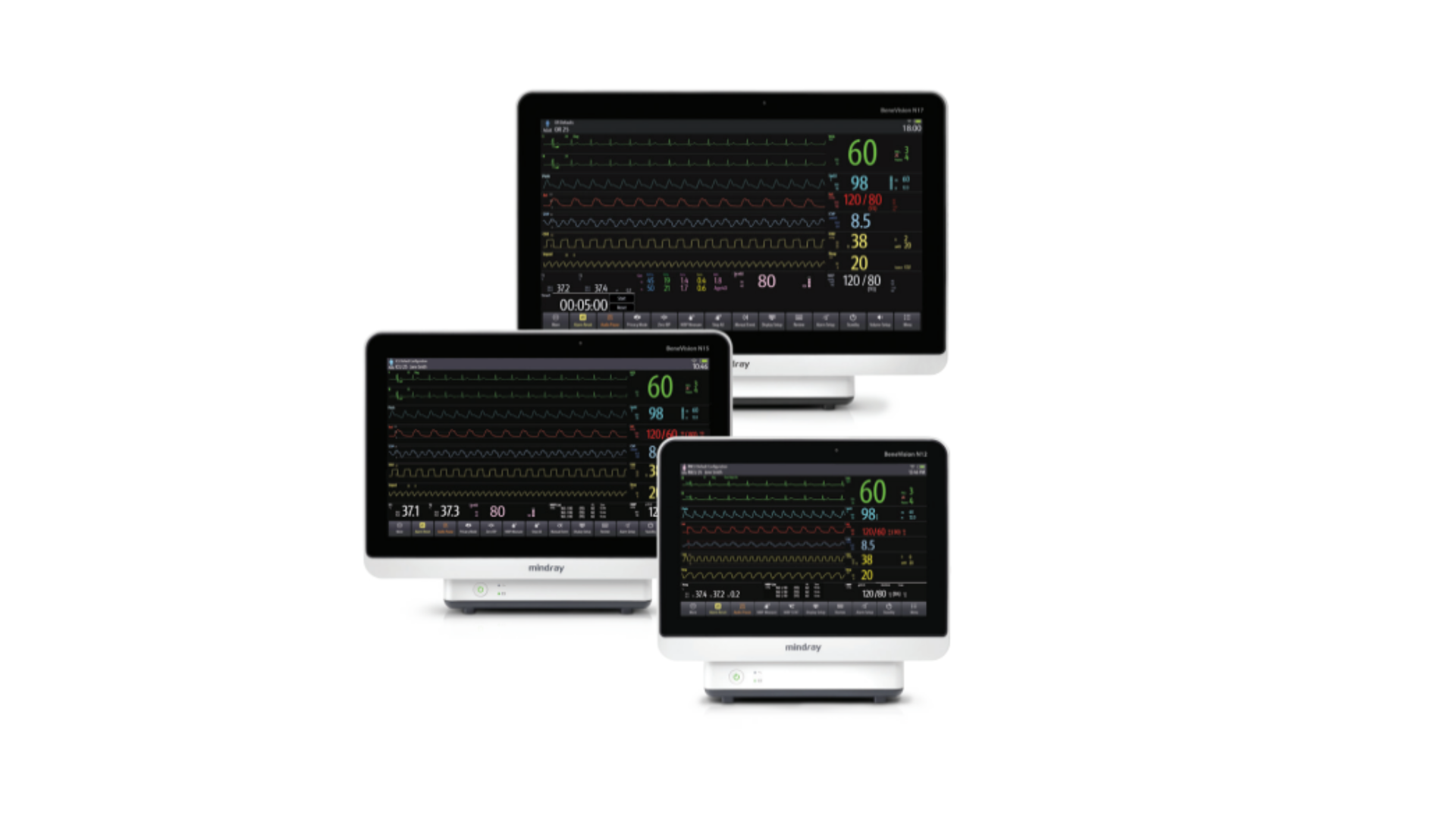 Mindray Patient Monitors - Siemens Healthineers USA