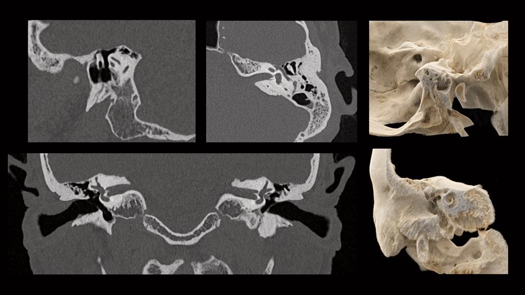 The Siemens Healthineers CT Imaging Chain - Siemens Healthineers