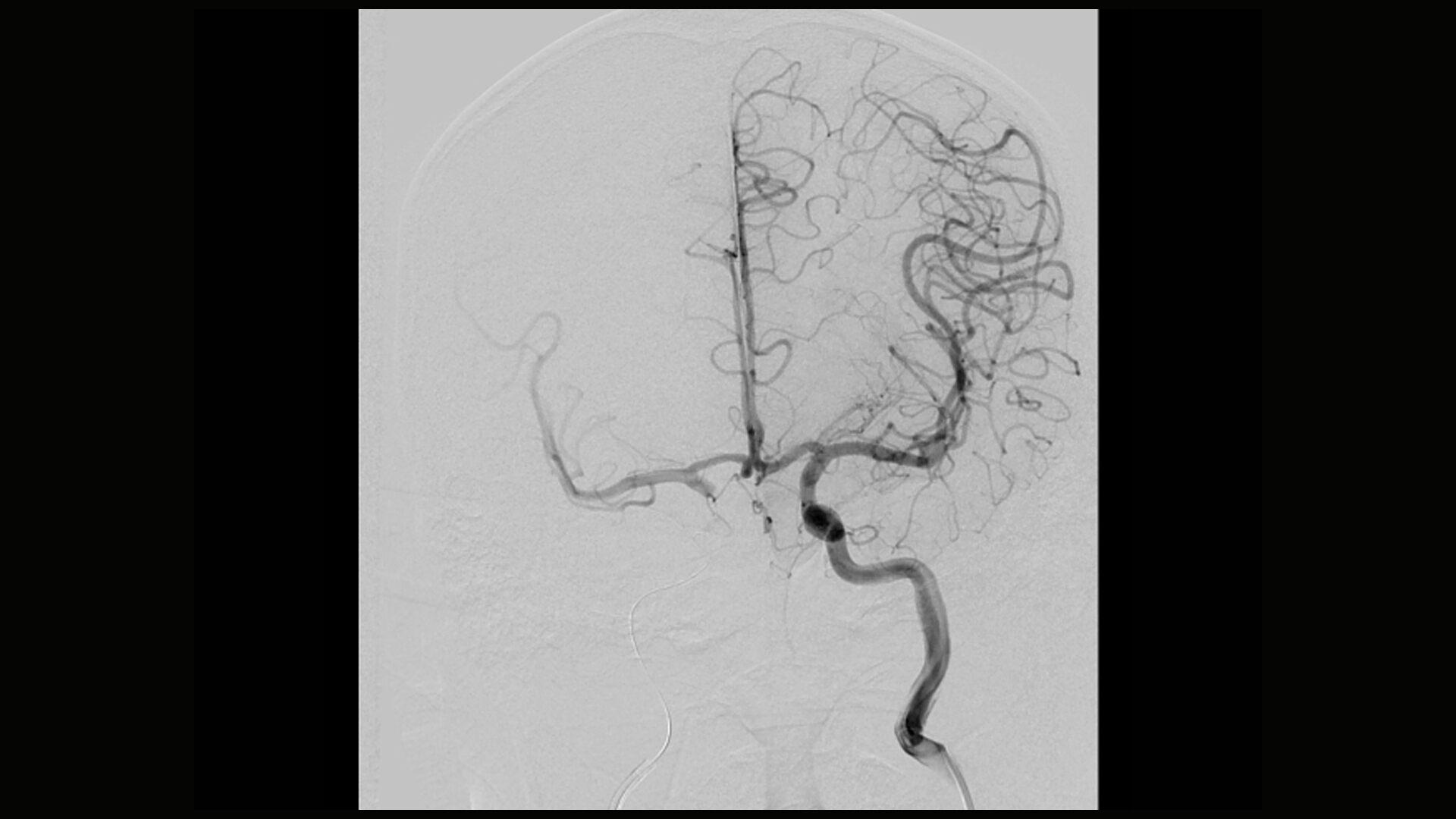 Neurosurgery - Siemens Healthineers