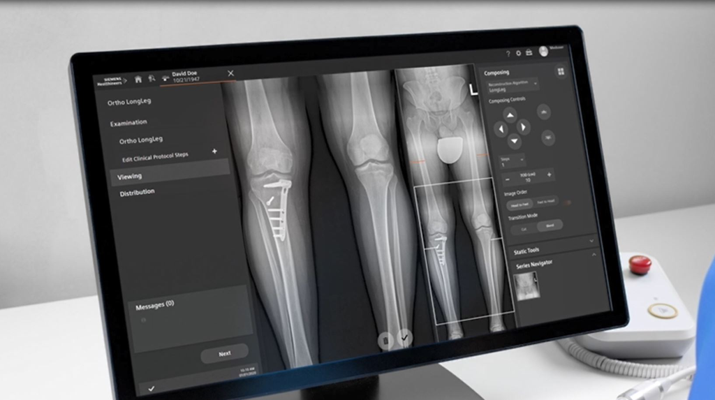 MULTIX Impact mit Smart Virtual Ortho - Siemens Healthineers Schweiz