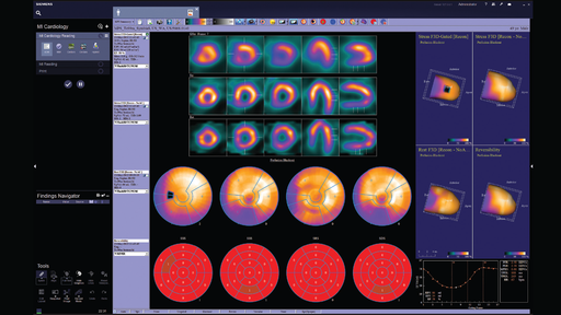 syngo.via for MI - Siemens Healthineers