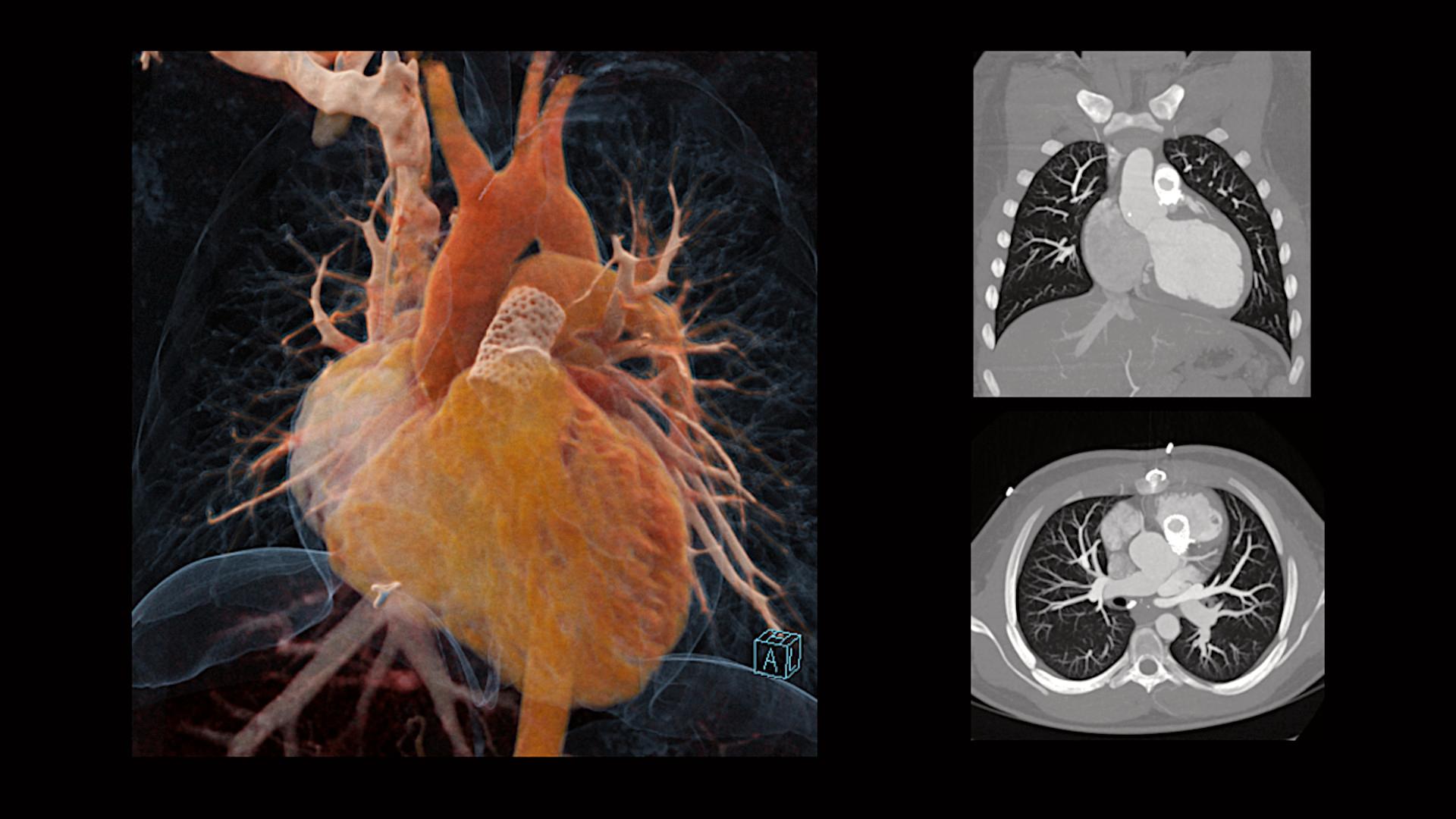 The Siemens Healthineers CT Imaging Chain - Siemens Healthineers