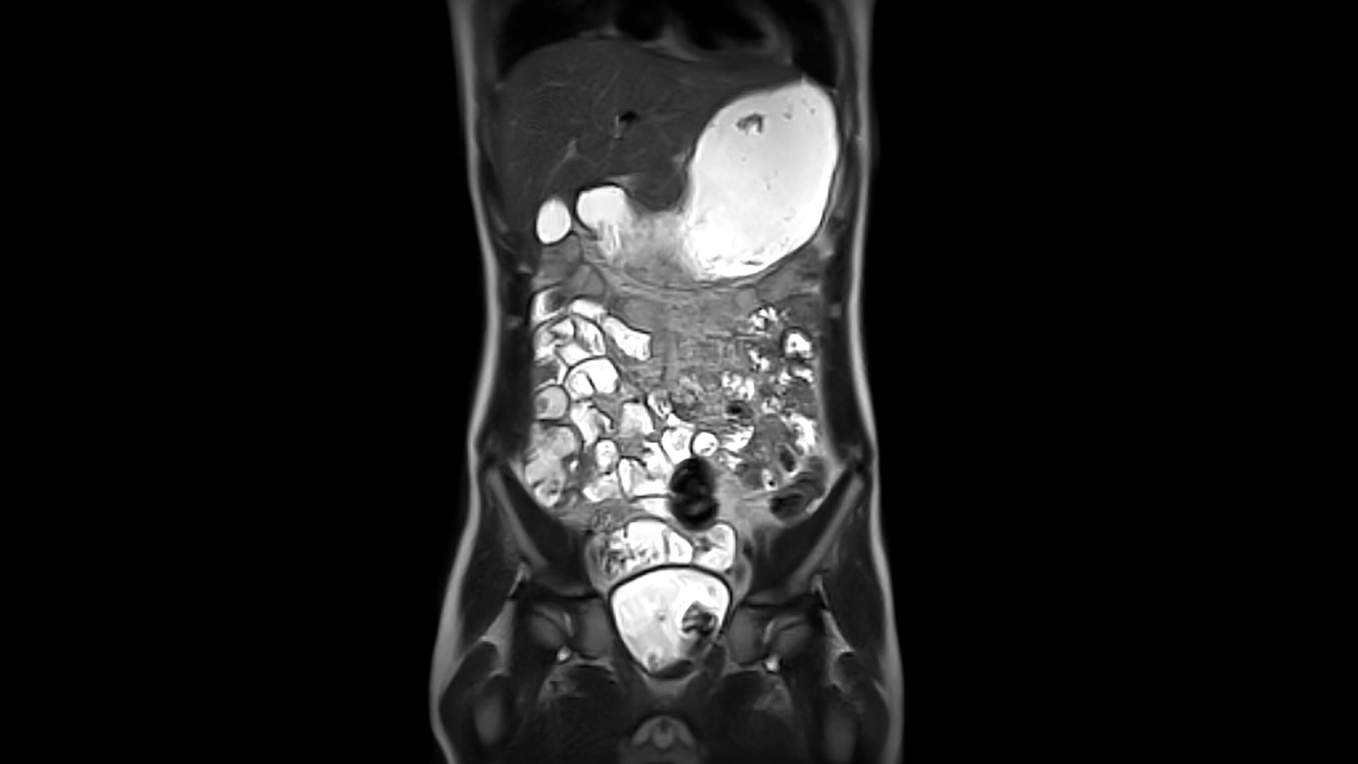 Phoenix Images for MAGNETOM Sola 1.5T