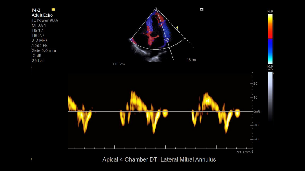 ACUSON Maple is a High-Performance Shared Service Ultrasound System ...