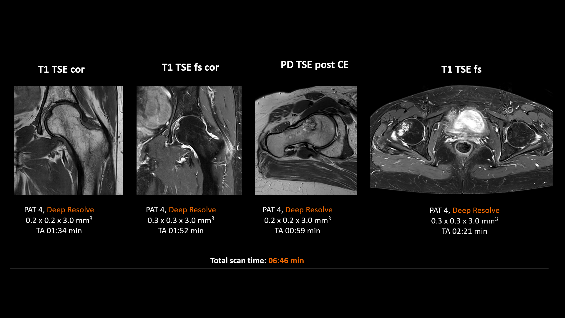 Musculoskeletal Imaging - Siemens Healthineers