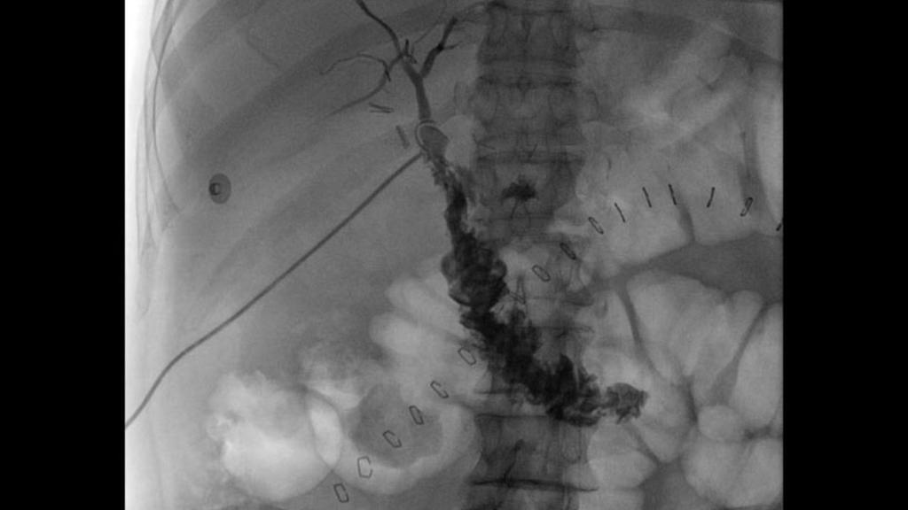 Luminos dRF Max Fluoroscopy Machine - Siemens Healthineers USA