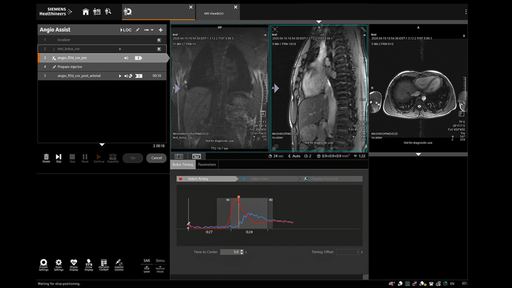Options & Upgrades - Get the most from your investment - Siemens ...