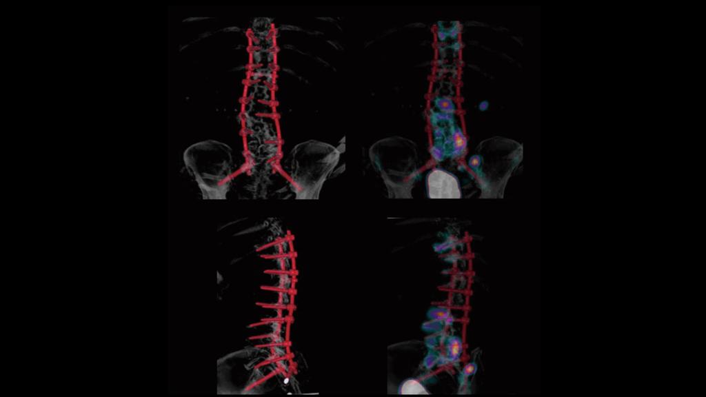Clinical Case Studies - Siemens Healthineers USA