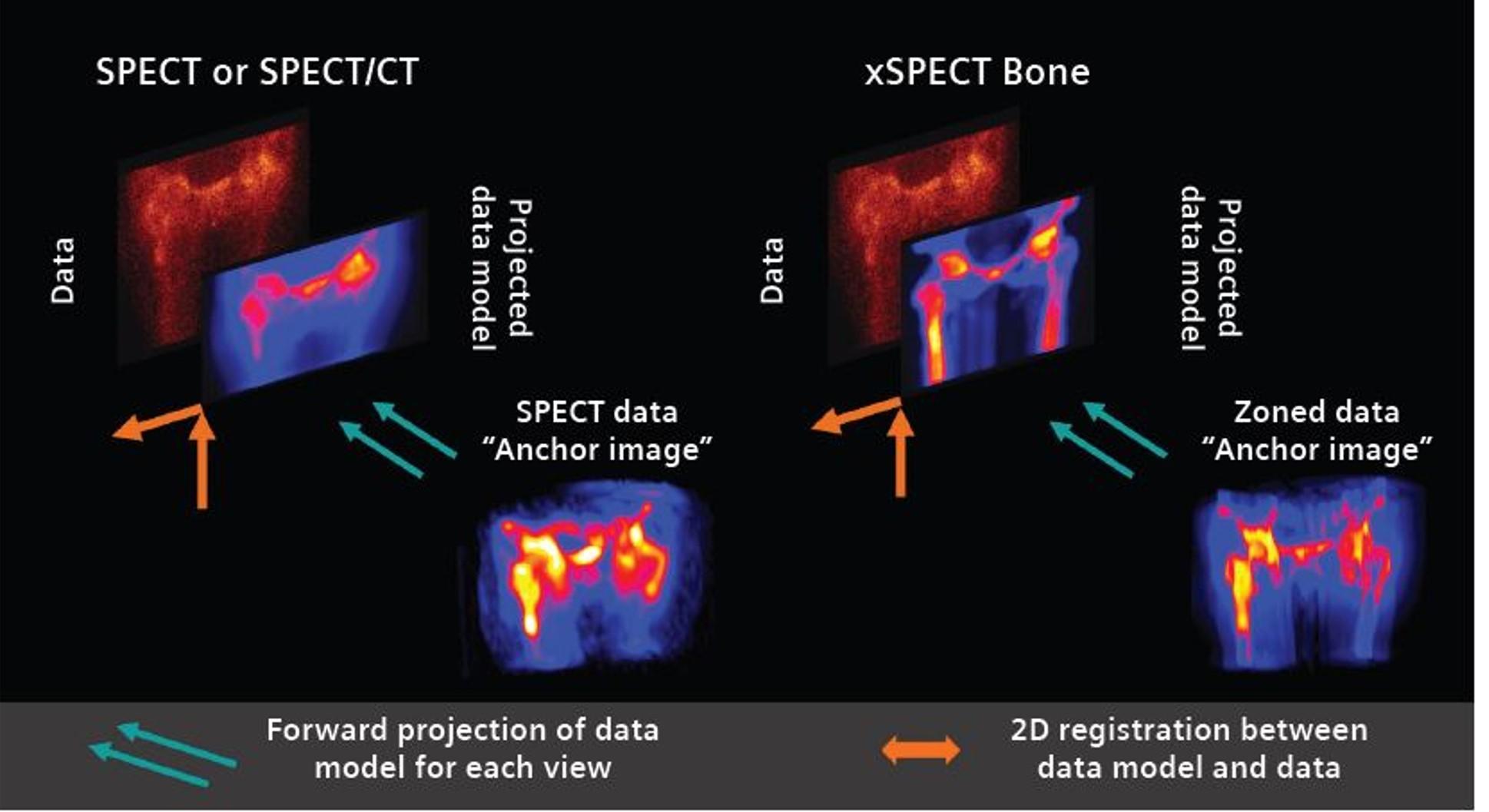 Data-driven mitigation of SPECT motion-induced artifacts - Siemens ...