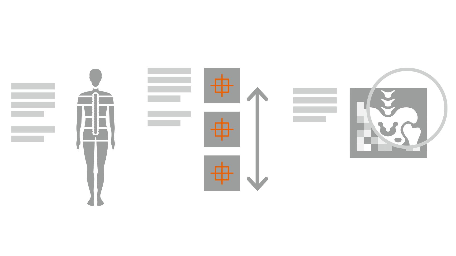 MULTIX Impact E - Siemens Healthineers