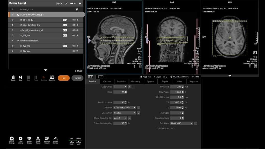 Neurology MRI - Siemens Healthineers