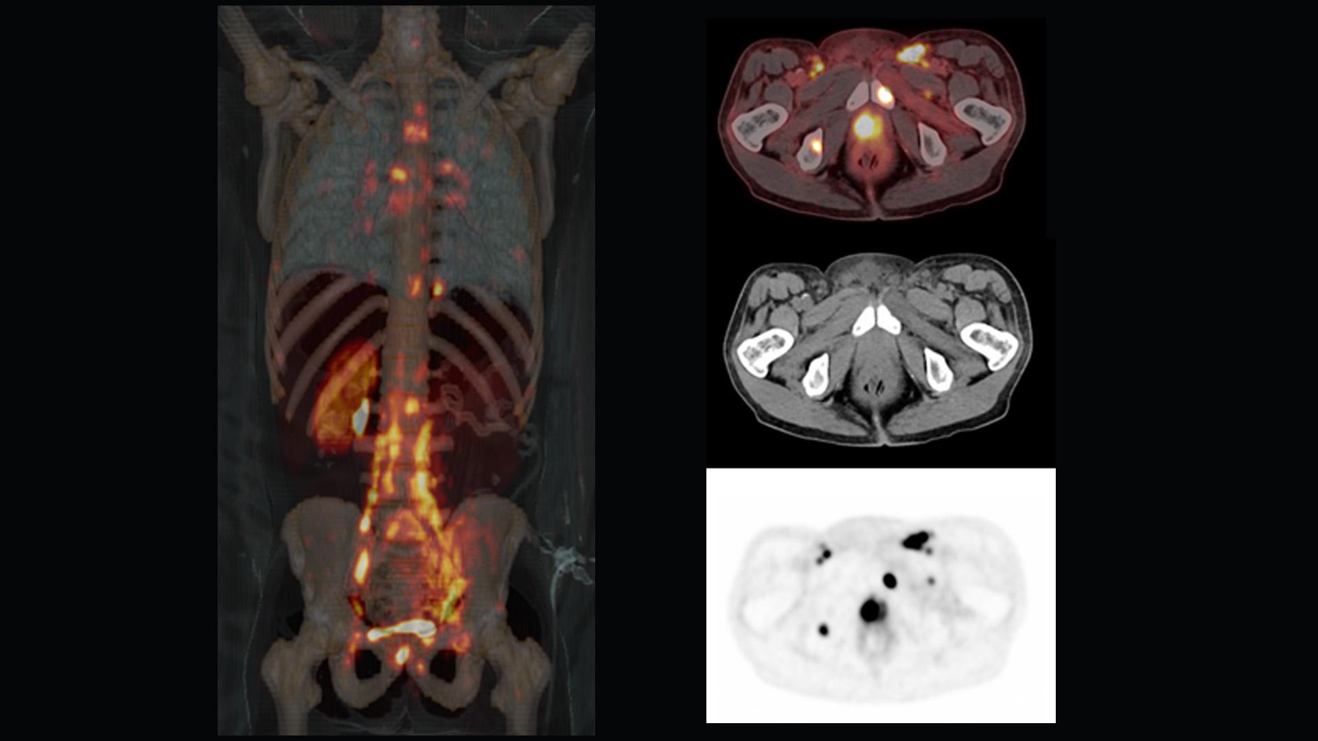 Molecular Imaging - Siemens Healthineers
