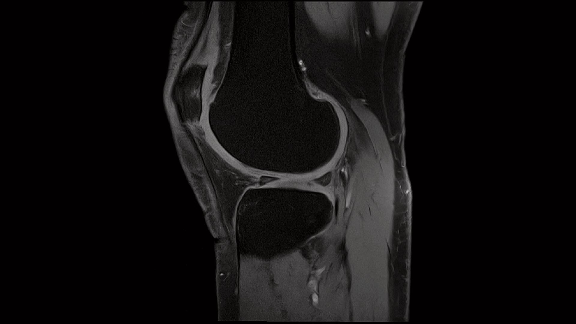 MAGNETOM Cima.X - Make the difference. - Siemens Healthineers