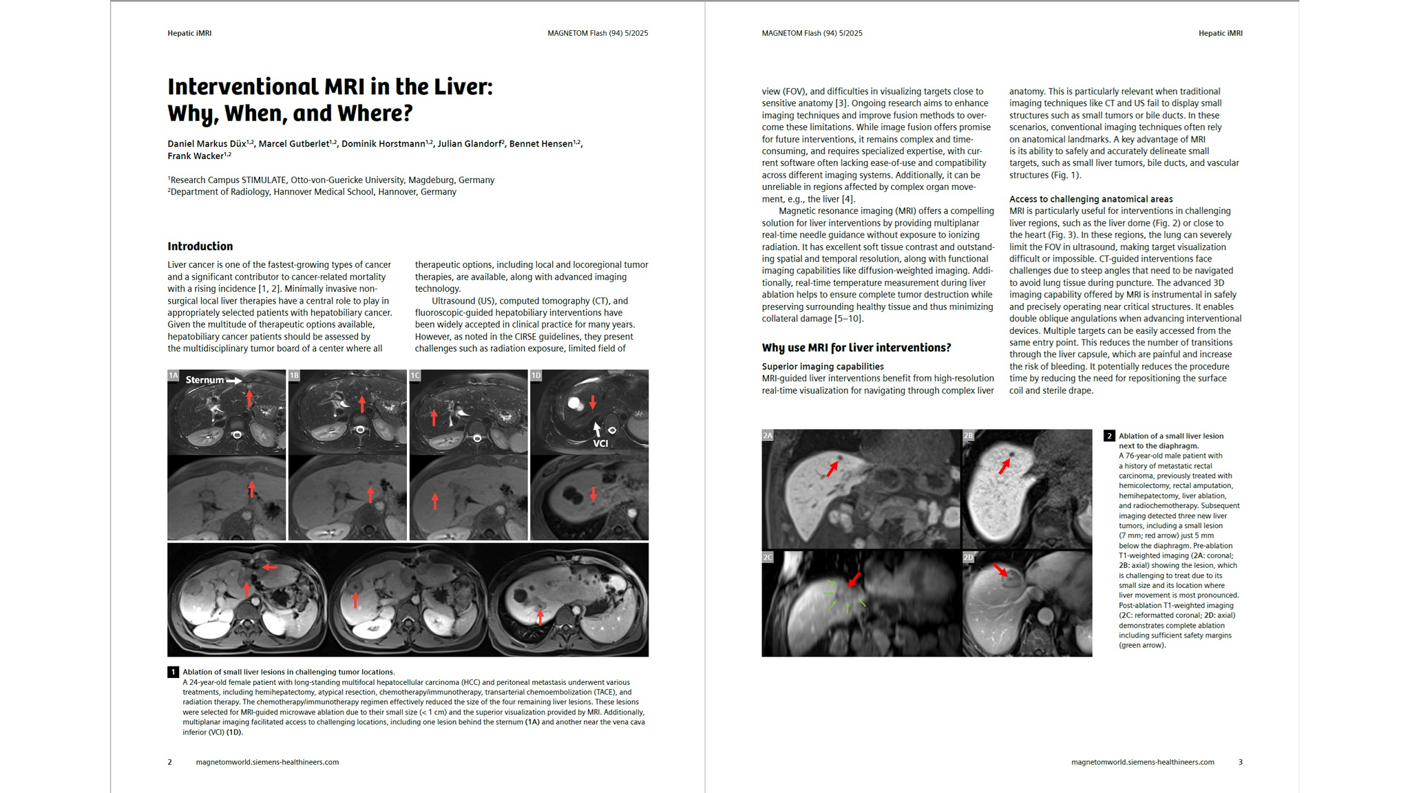 MRI Case Studies, MRI Case Study, MRI Case