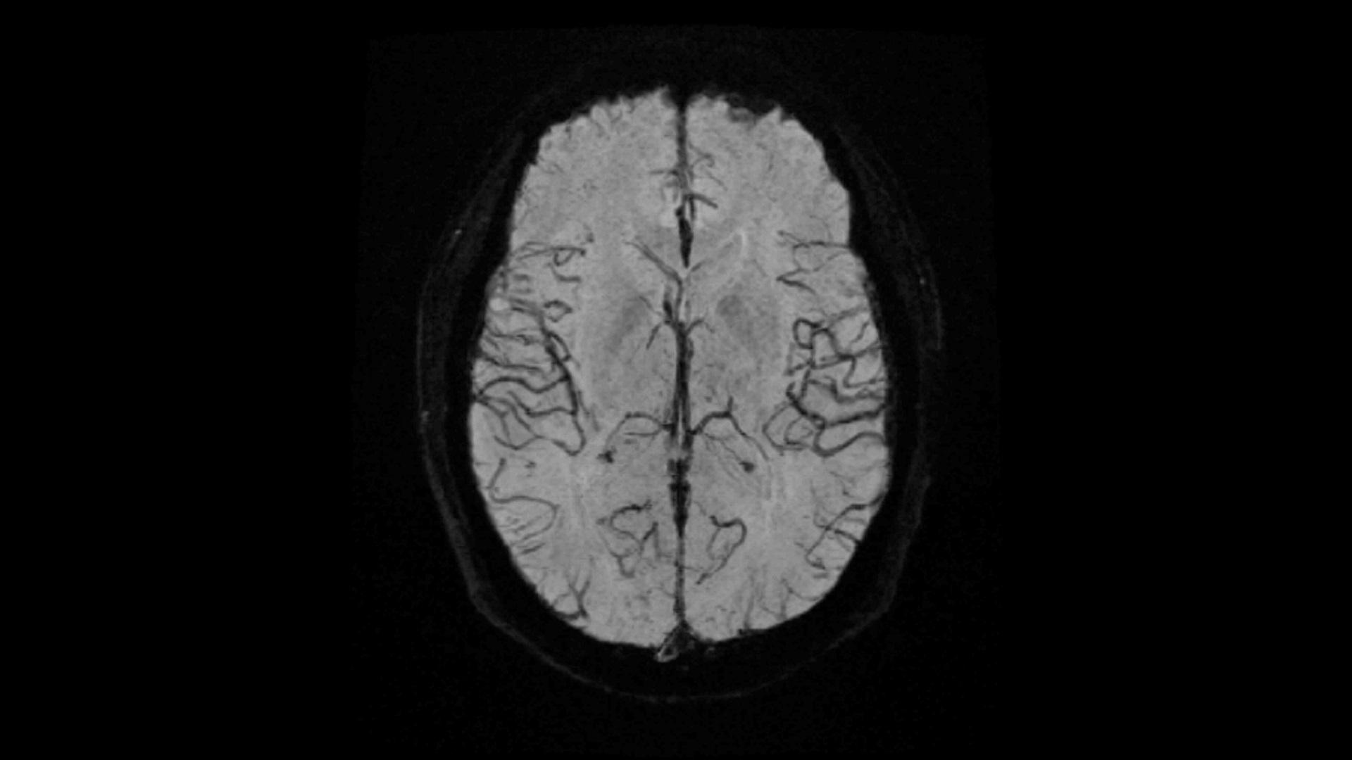 MAGNETOM Free.Max – Open Bore MRI - Siemens Healthineers USA