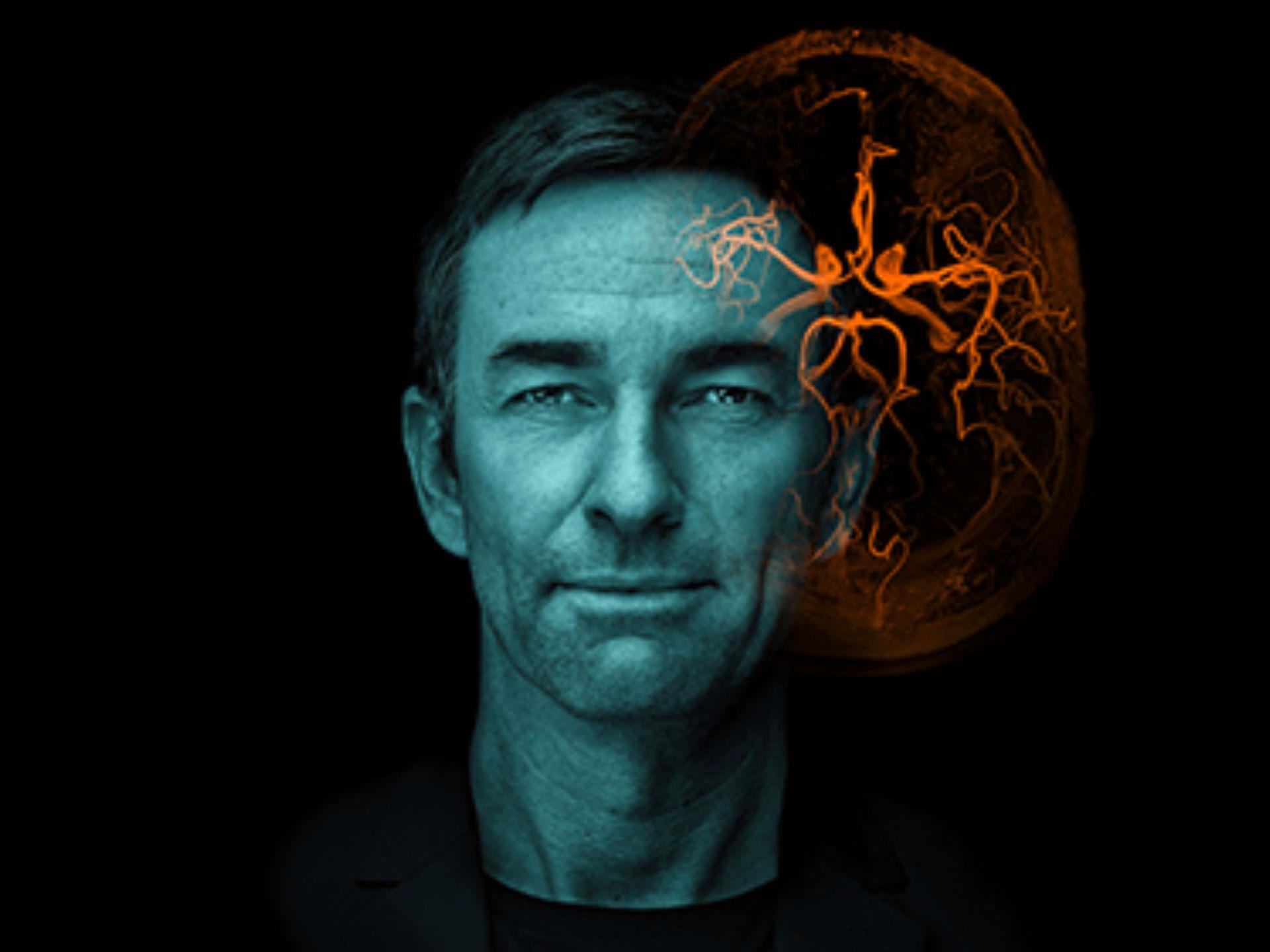 Neurology - Siemens Healthineers USA