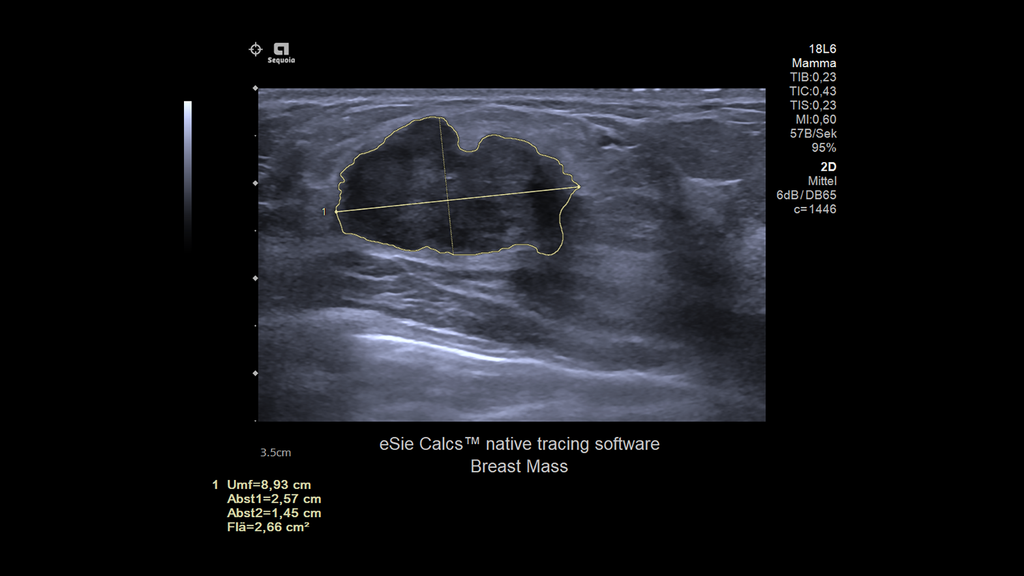 ACUSON Sequoia Ultrasound System - Siemens Healthineers