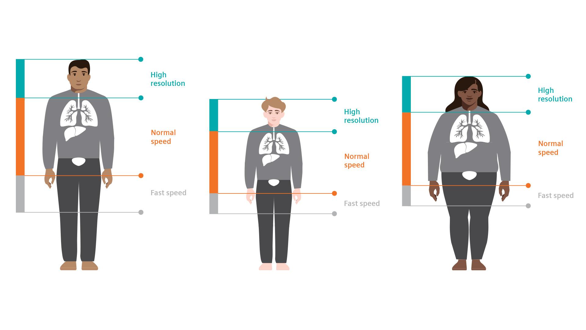 FlowMotion AI - Moving The Standard To Personalized Care - Siemens ...