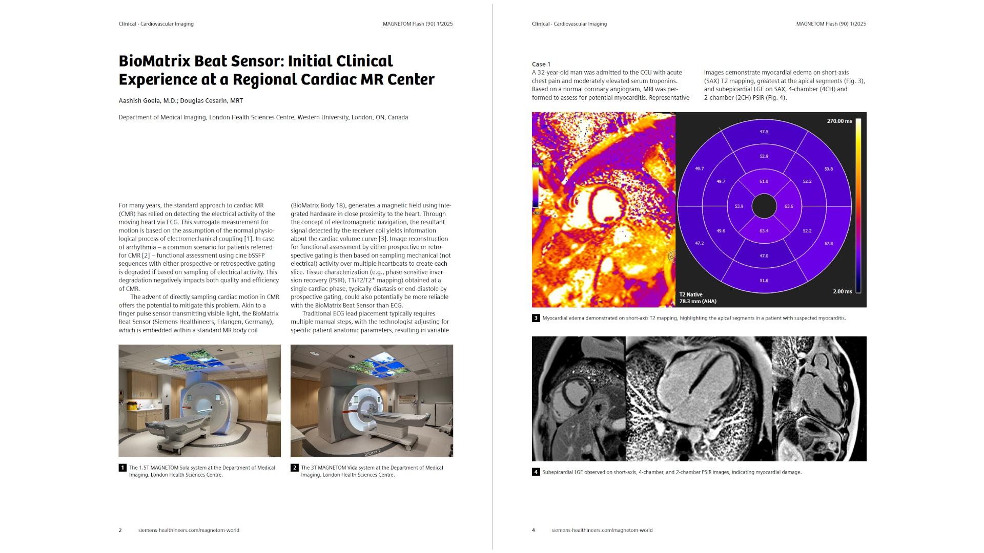 BioMatrix Beat Sensor: Initial Clinical Experience at a Regional ...