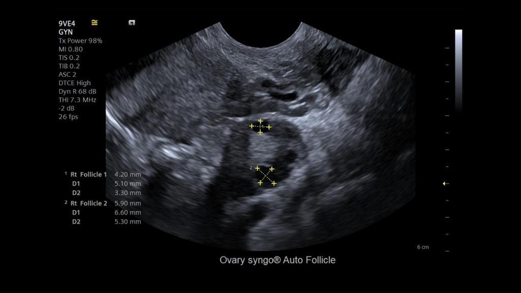 ACUSON Maple is a High-Performance Shared Service Ultrasound System ...