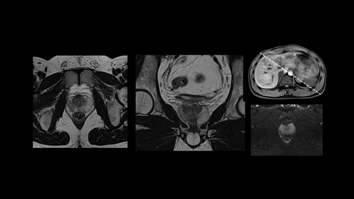 From Pixels to Picture: MR Body Imaging - Siemens Healthineers Malaysia