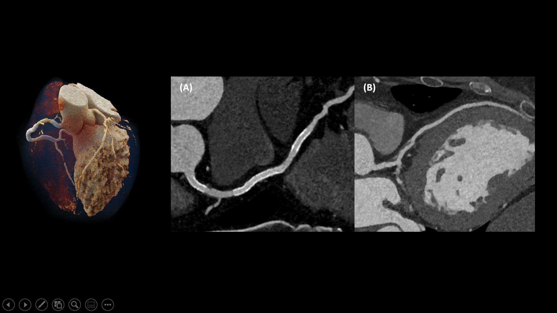 フォトンカウンティングCT「NAEOTOM Alpha」が急性期医療を担う板橋中央総合病院で稼働開始 - Siemens ...
