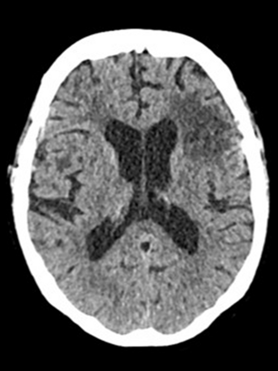 SOMATOM Pro.Pulse Dual Source CT-Scanner – Siemens Healthineers Deutschland