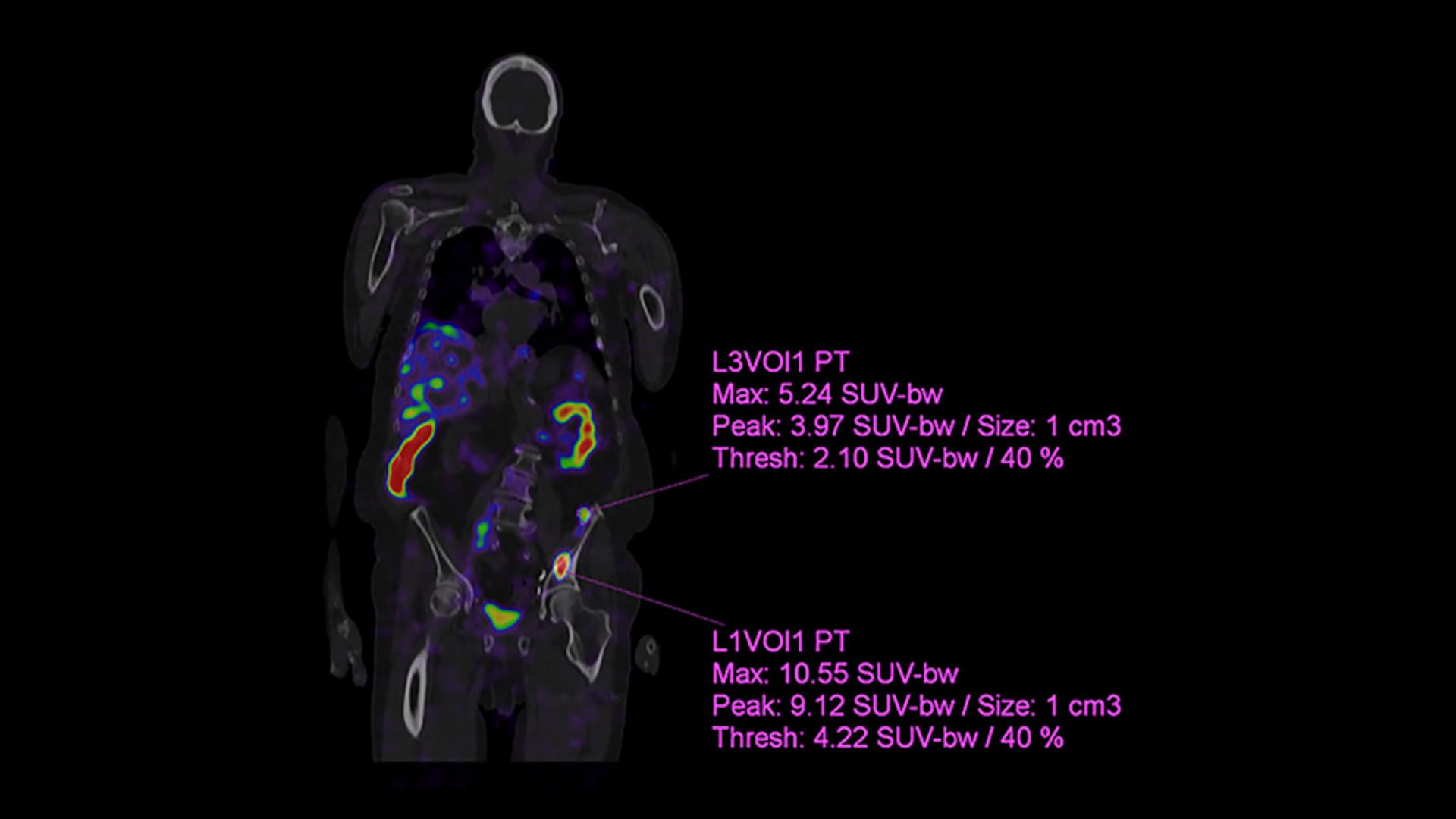Symbia Pro.specta SPECT/CT Fast imaging - Siemens Healthineers