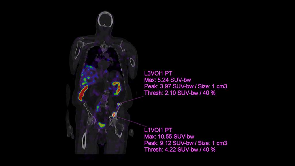 Symbia Pro.specta SPECT/CT Fast imaging - Siemens Healthineers