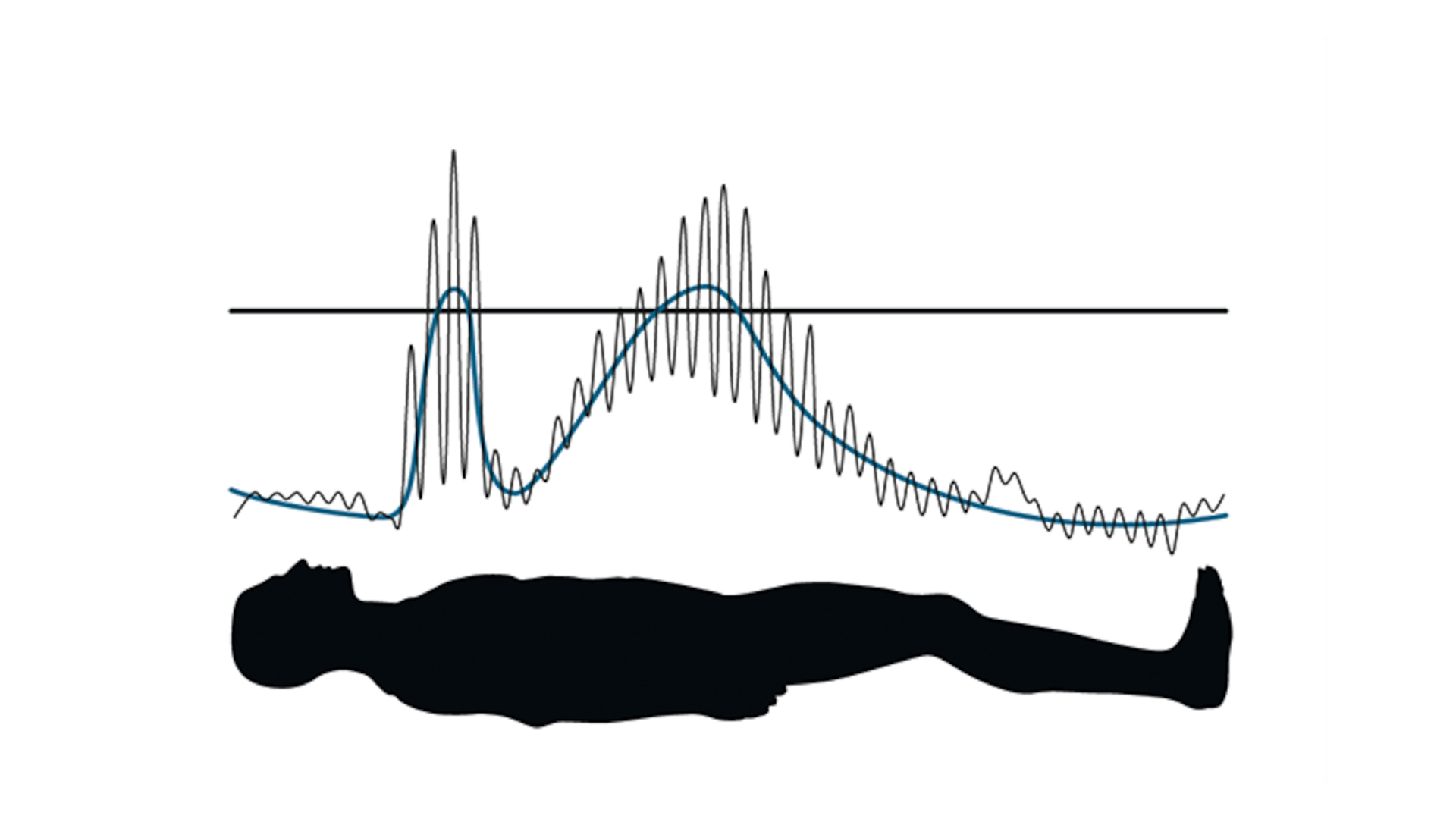 Dual Energy CT Spectral Imaging - Siemens Healthineers USA