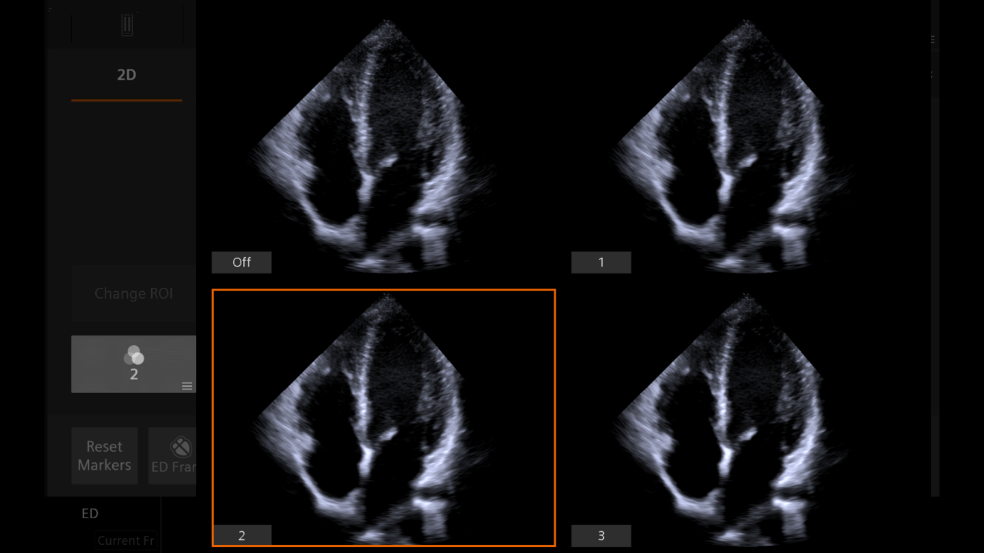 ACUSON Redwood, CV Edition Ultrasound System, CV Edition - Siemens ...