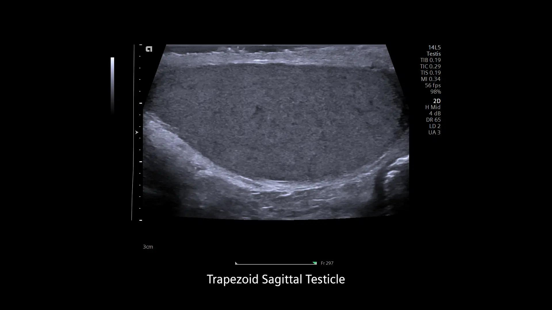 ACUSON Redwood Ultrasound System - Siemens Healthineers
