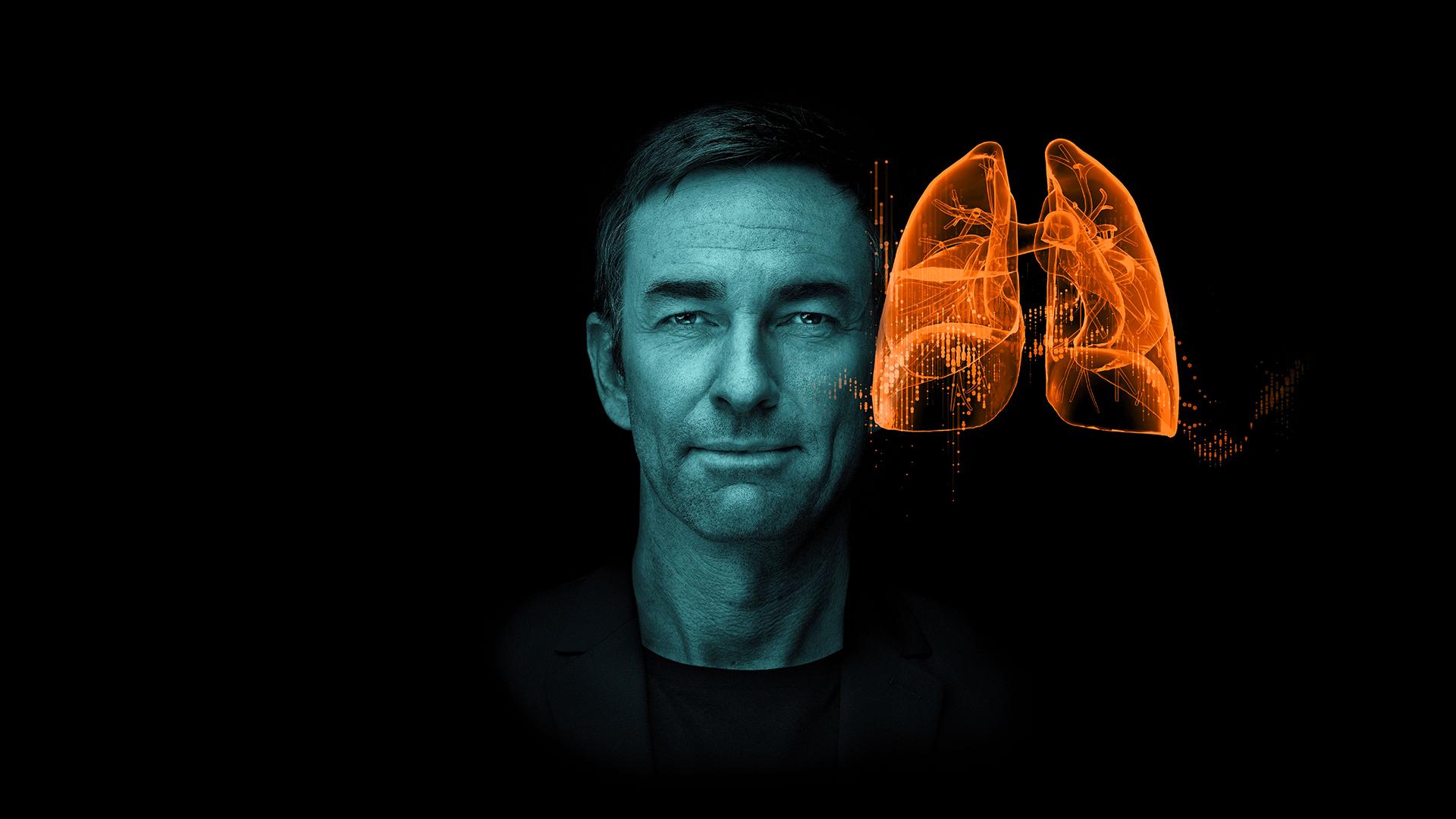 Deep Breaths: A Deep Dive on Thoracic Imaging Webinar - Siemens ...