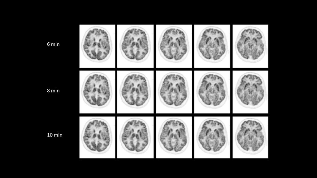 Biograph Trinion PET/CT scanner - Siemens Healthineers USA