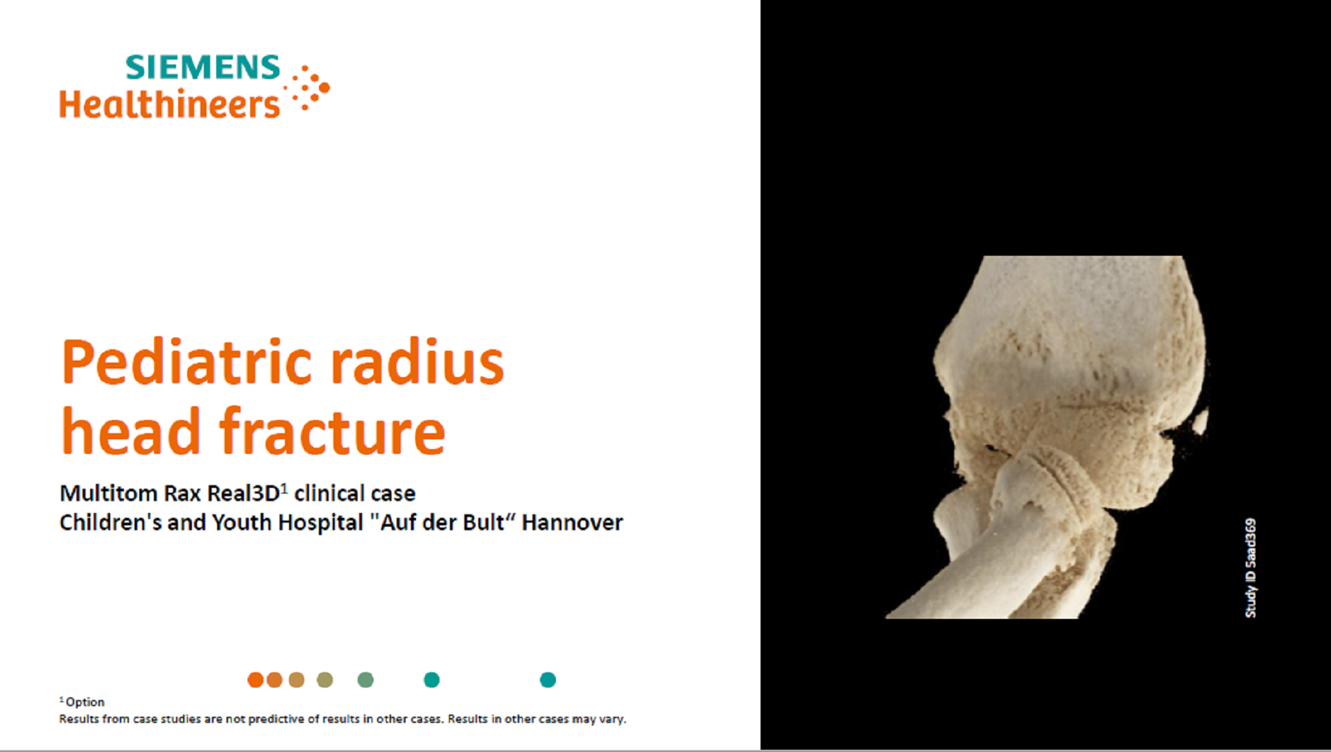 Robotic X-Ray - Clinical Case Library - Siemens Healthineers