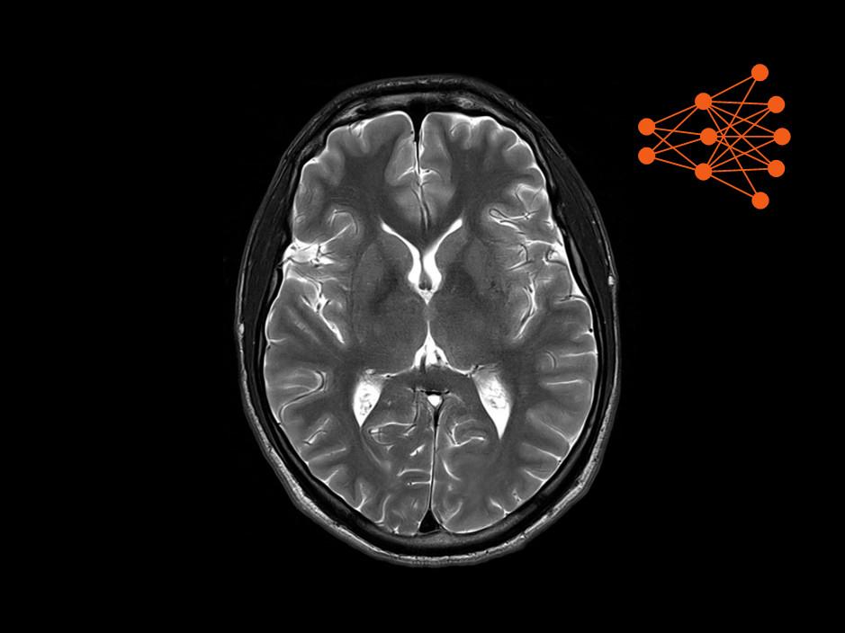 Pediatric protocols using Deep Resolve