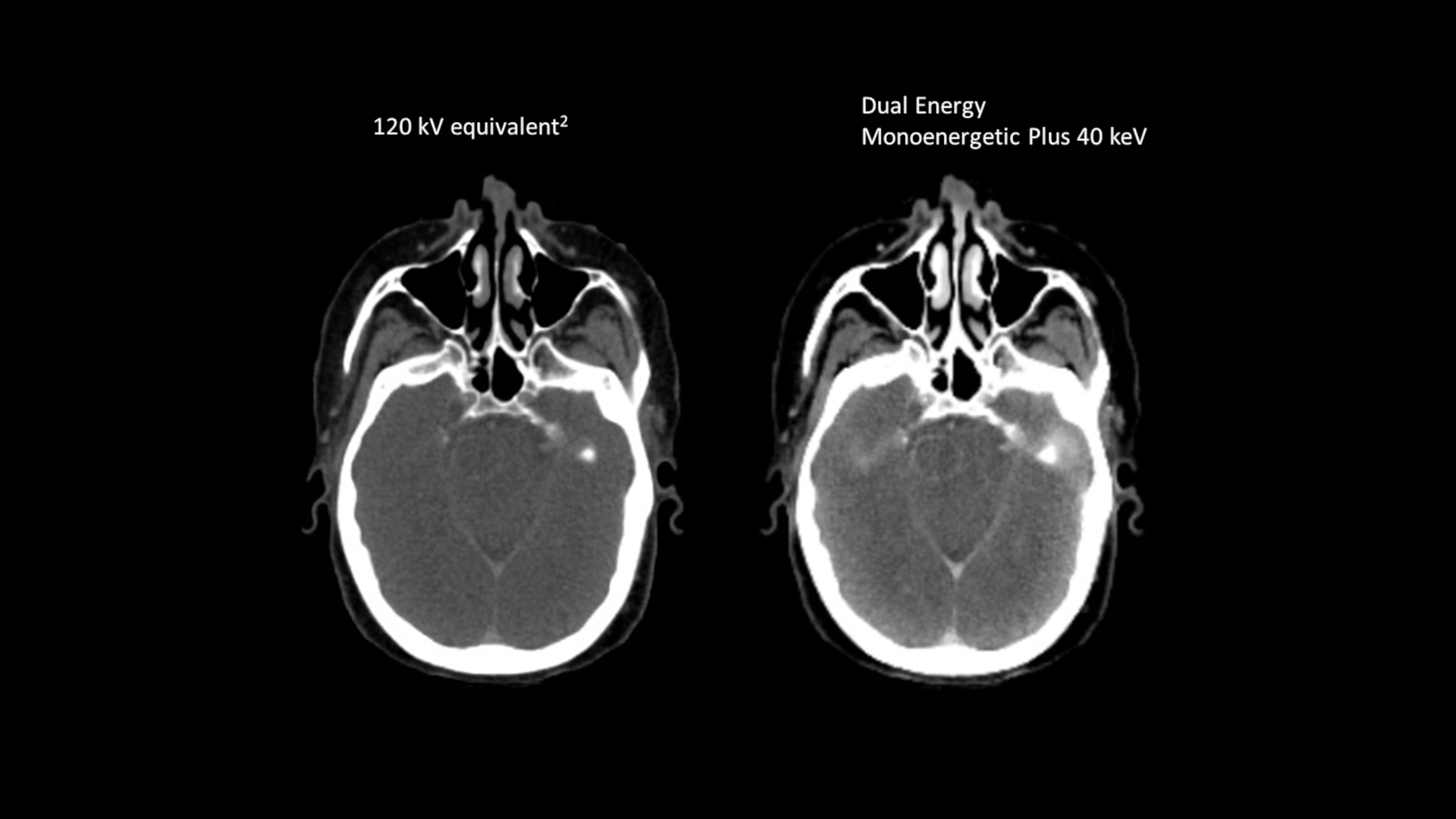 SOMATOM go.Sim - Siemens Healthineers
