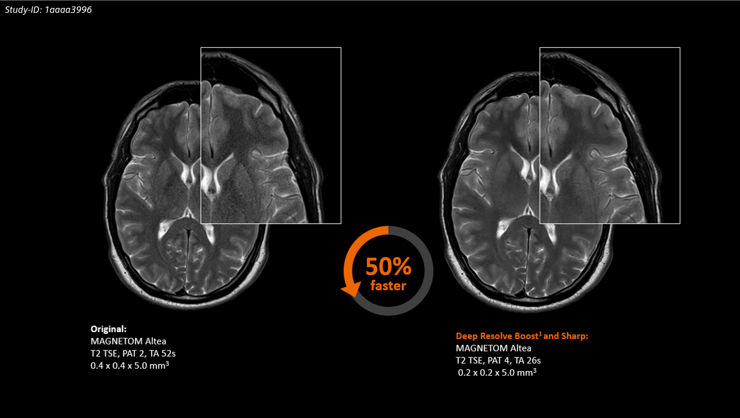 MAGNETOM Altea - Siemens Healthineers USA