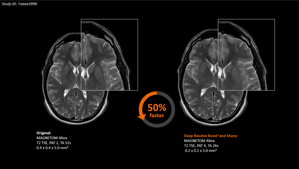MAGNETOM Altea - Siemens Healthineers USA