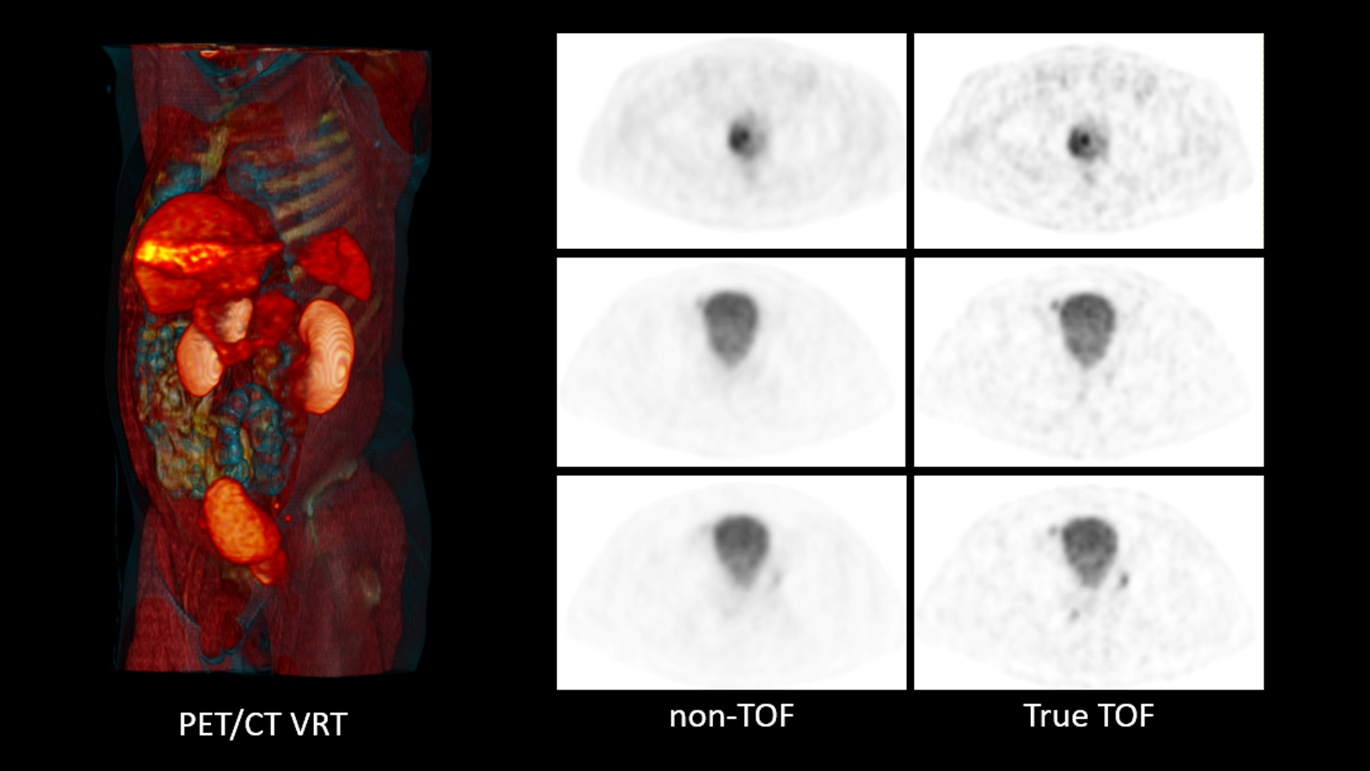 Digital Pet Ct Siemens at Stanley Musso blog