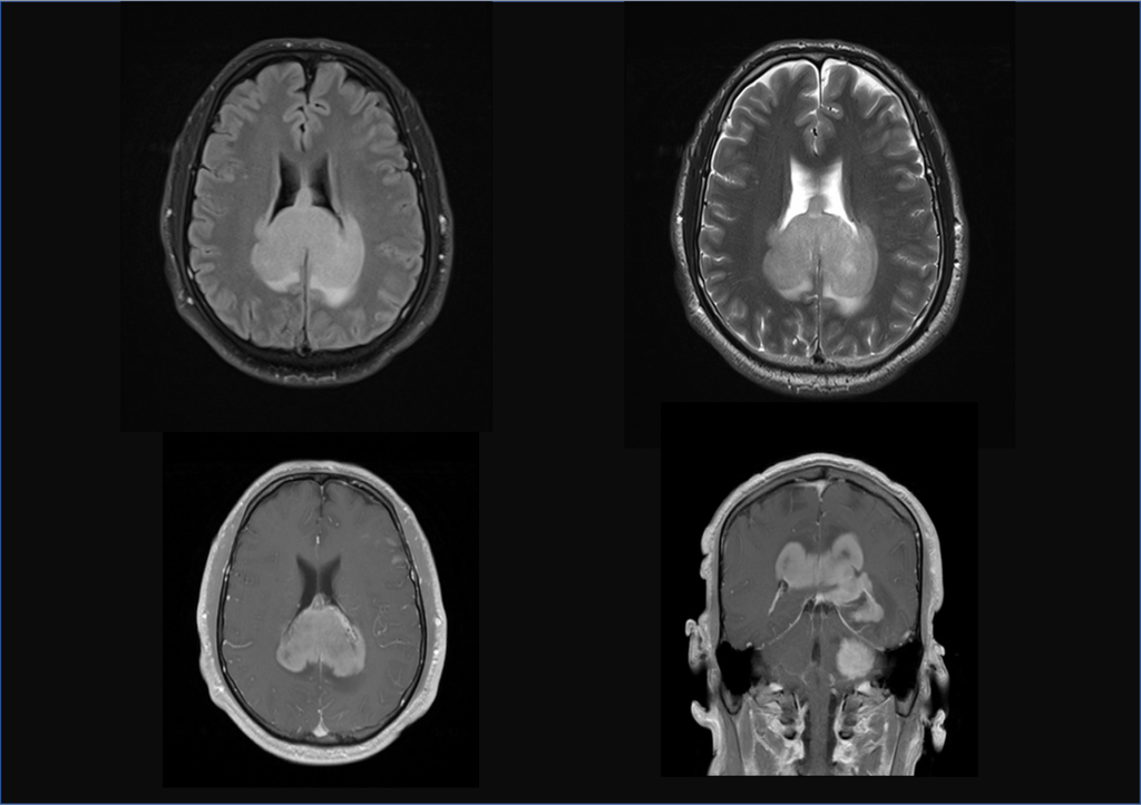 Introducing 3T MR Imaging with the New MAGNETOM Vida