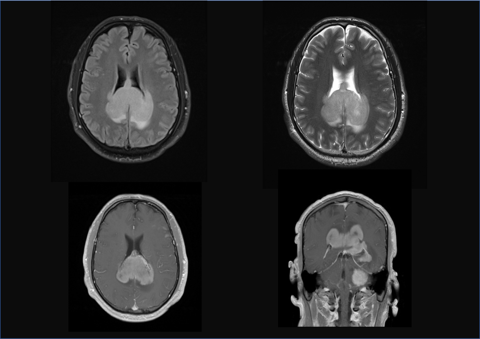 Introducing 3T MR Imaging with the New MAGNETOM Vida